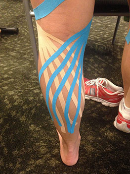 KT Taping | Kinesio Taping | Taping For Pain Relief | Akron